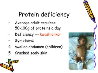 Chapter 4 Nutrients Lesson 2 - Fats and proteins | PPT
