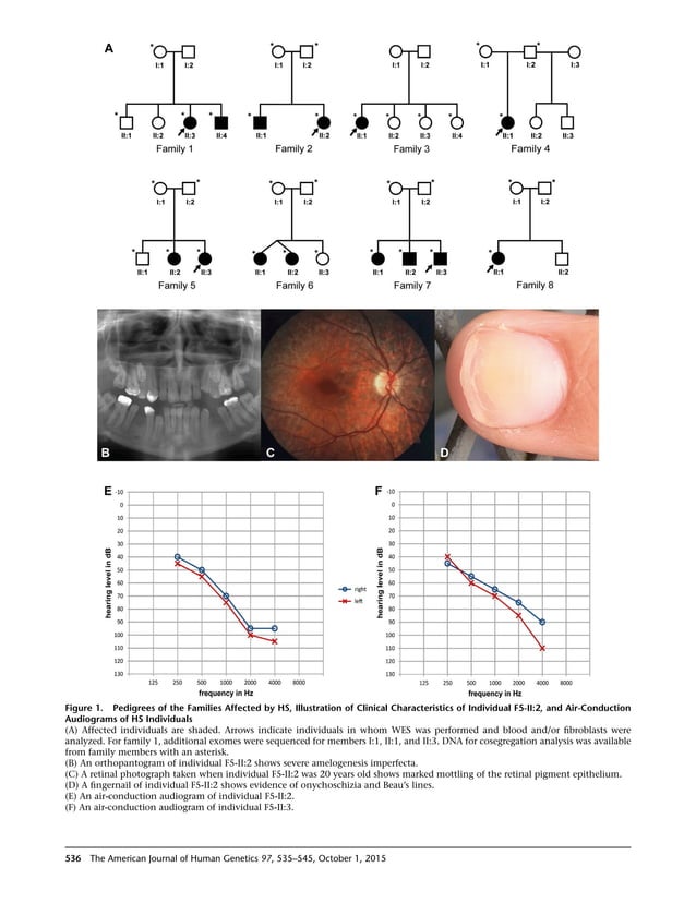 Heimler Syndrome Paper | PDF
