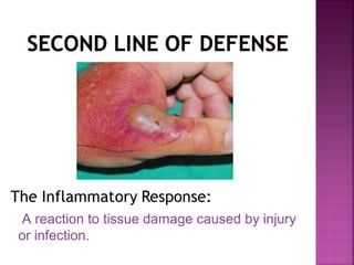 2 fighting communicable diseases | PPT