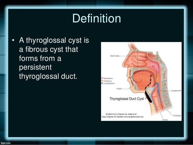 Case of the week : Thyroglossal cyst
