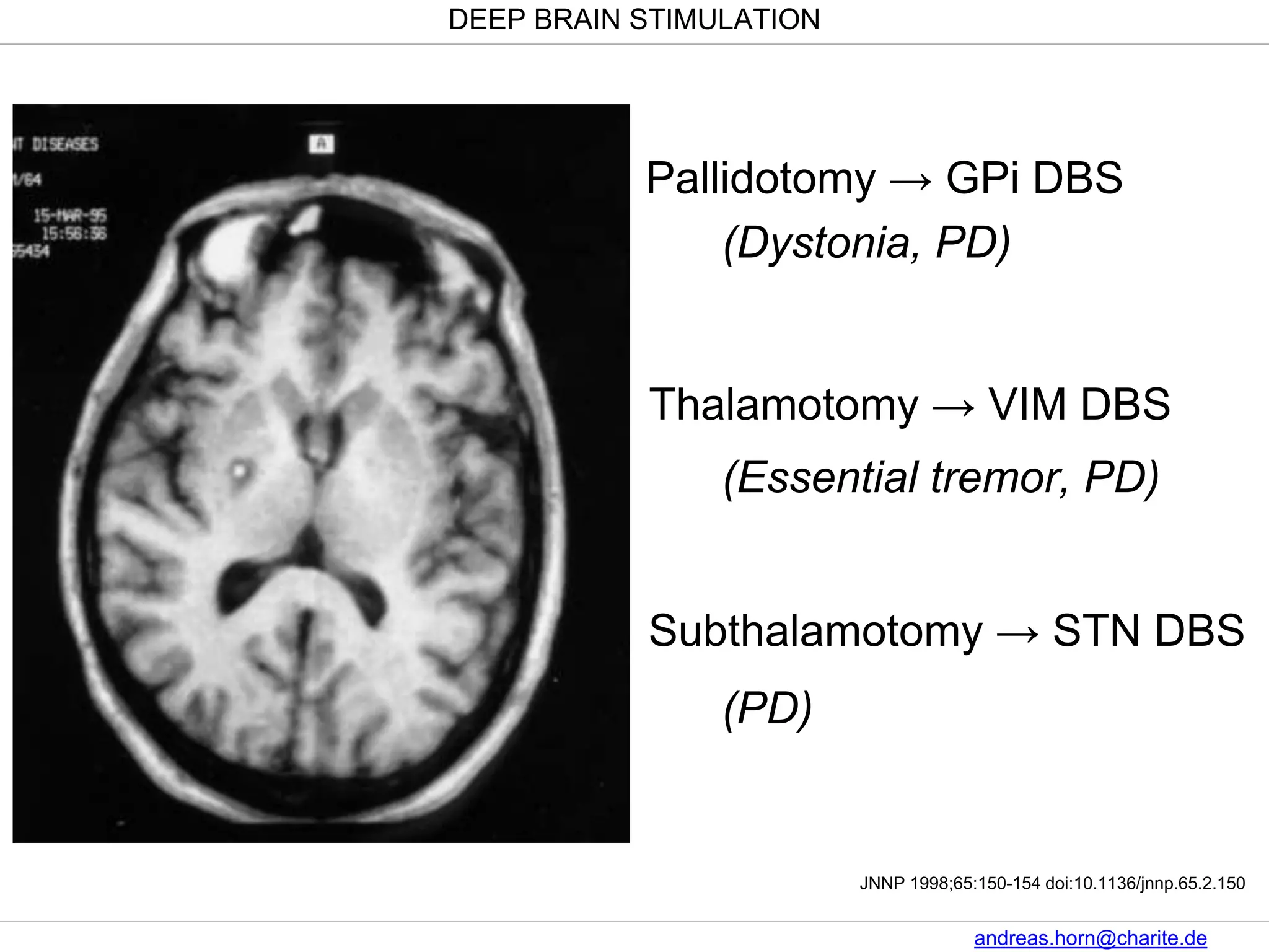 Function & Anatomy of the Basal Ganglia | PPTX