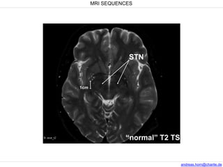 Function & Anatomy of the Basal Ganglia | PPTX