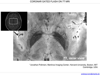 Function & Anatomy of the Basal Ganglia | PPTX