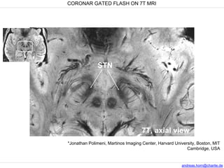 Function & Anatomy of the Basal Ganglia | PPTX