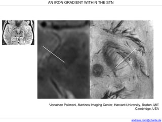 Function & Anatomy of the Basal Ganglia | PPTX
