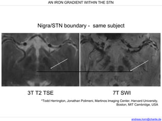 Function & Anatomy of the Basal Ganglia | PPTX