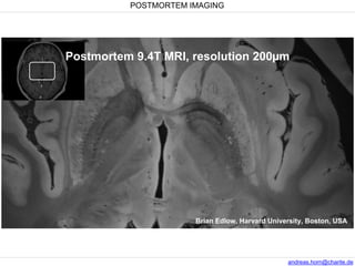 Function & Anatomy of the Basal Ganglia | PPTX