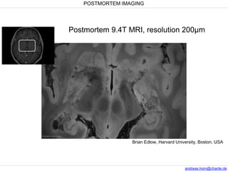 Function & Anatomy of the Basal Ganglia | PPTX