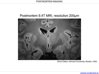 Function & Anatomy of the Basal Ganglia | PPTX
