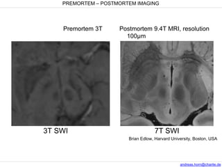 Function & Anatomy of the Basal Ganglia | PPTX