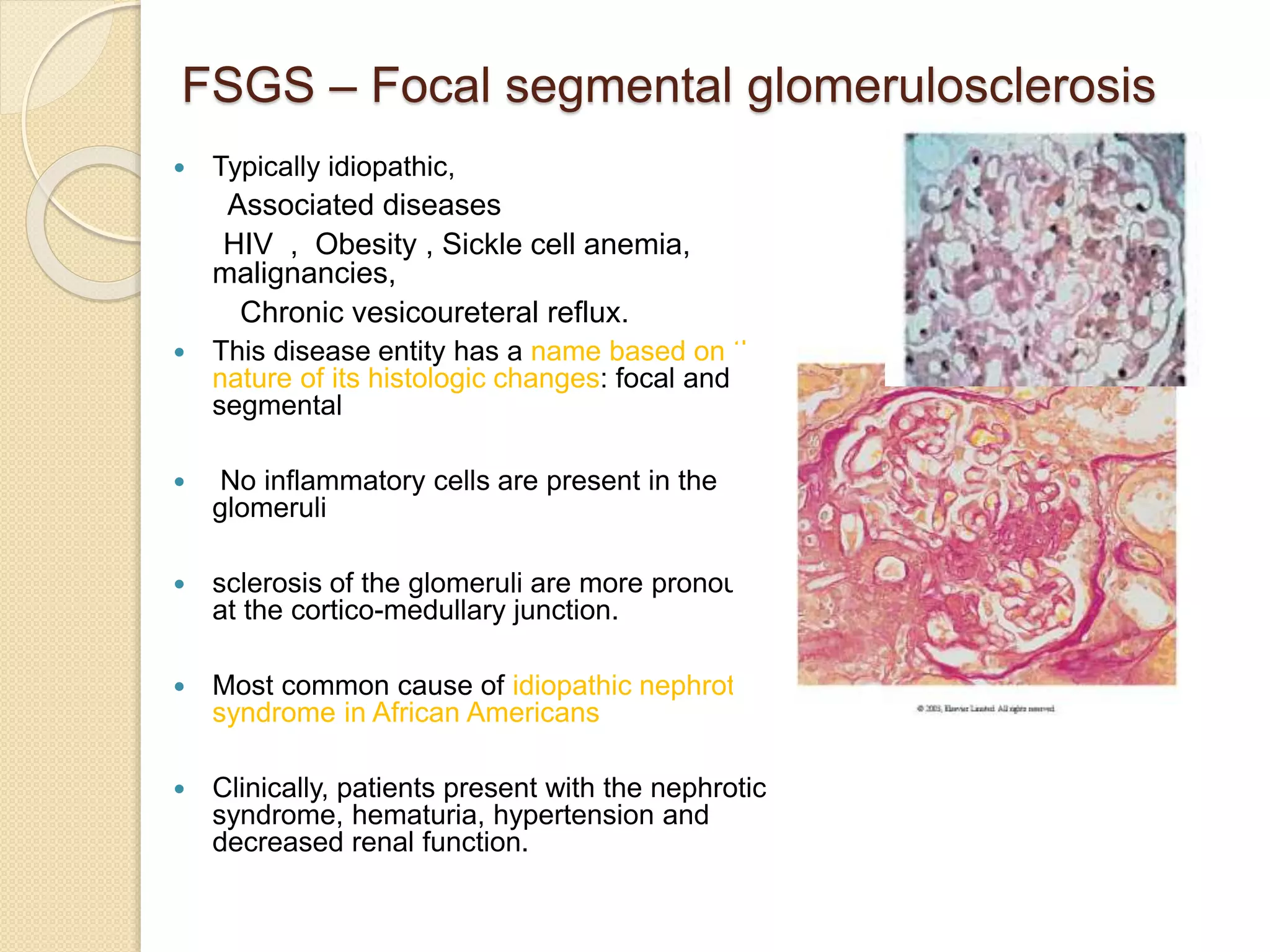 2 GLOMERULAR DISEASES.pptx