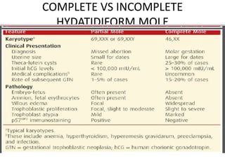 Molar pregnancy | PPTX