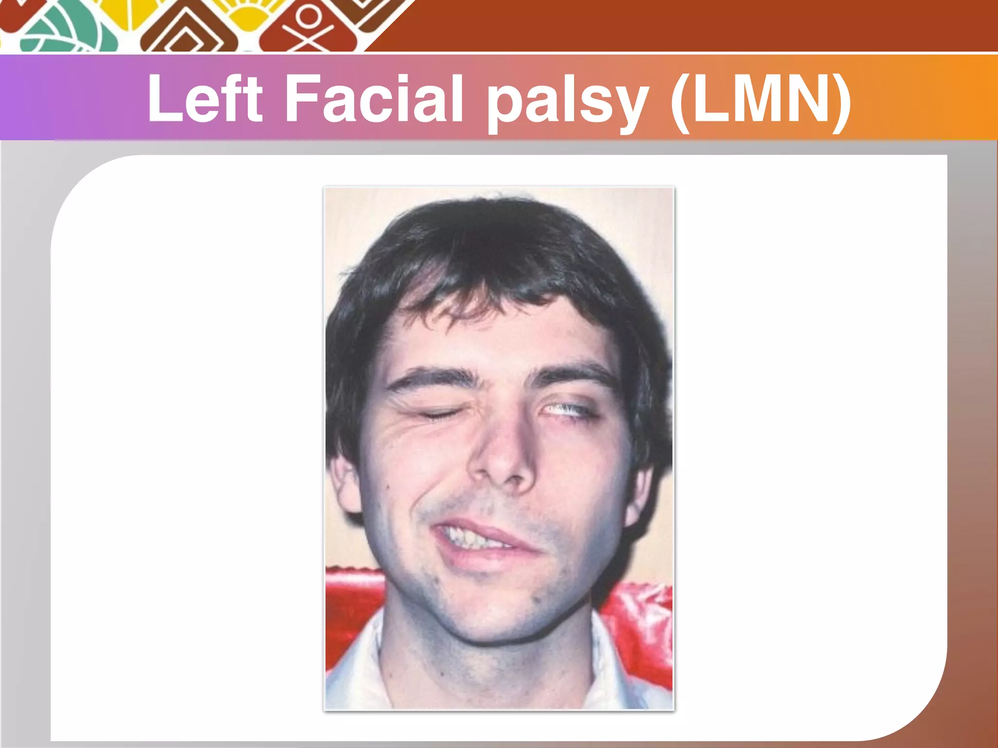 Motor weakness and Cerebrovascular Disease | PDF