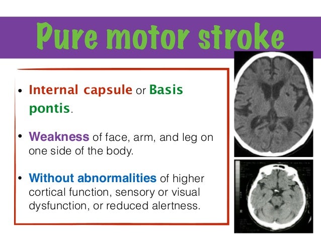 Motor weakness and Cerebrovascular Disease