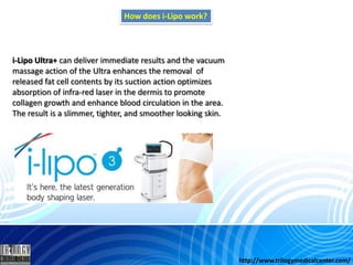 i lipo | PPT
