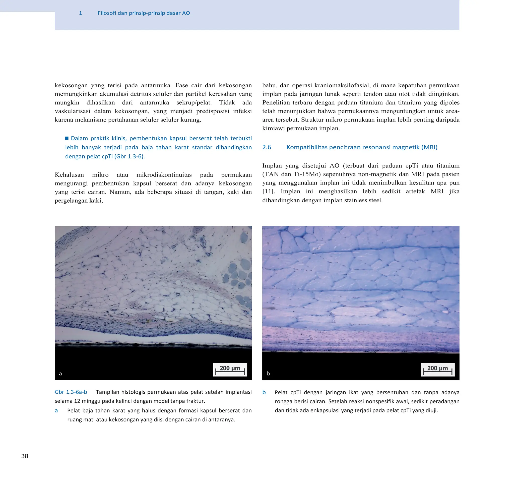 AO Trauma orthopaedic principle of fracture management part 2.pdf