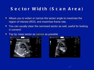 Image Optimization for Critical Care Ultrasound | PPT