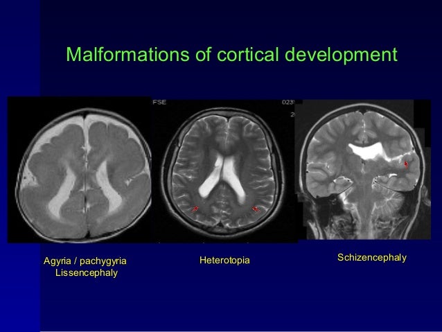 Integrated Diagnostics – A Unique Epilepsy Approach