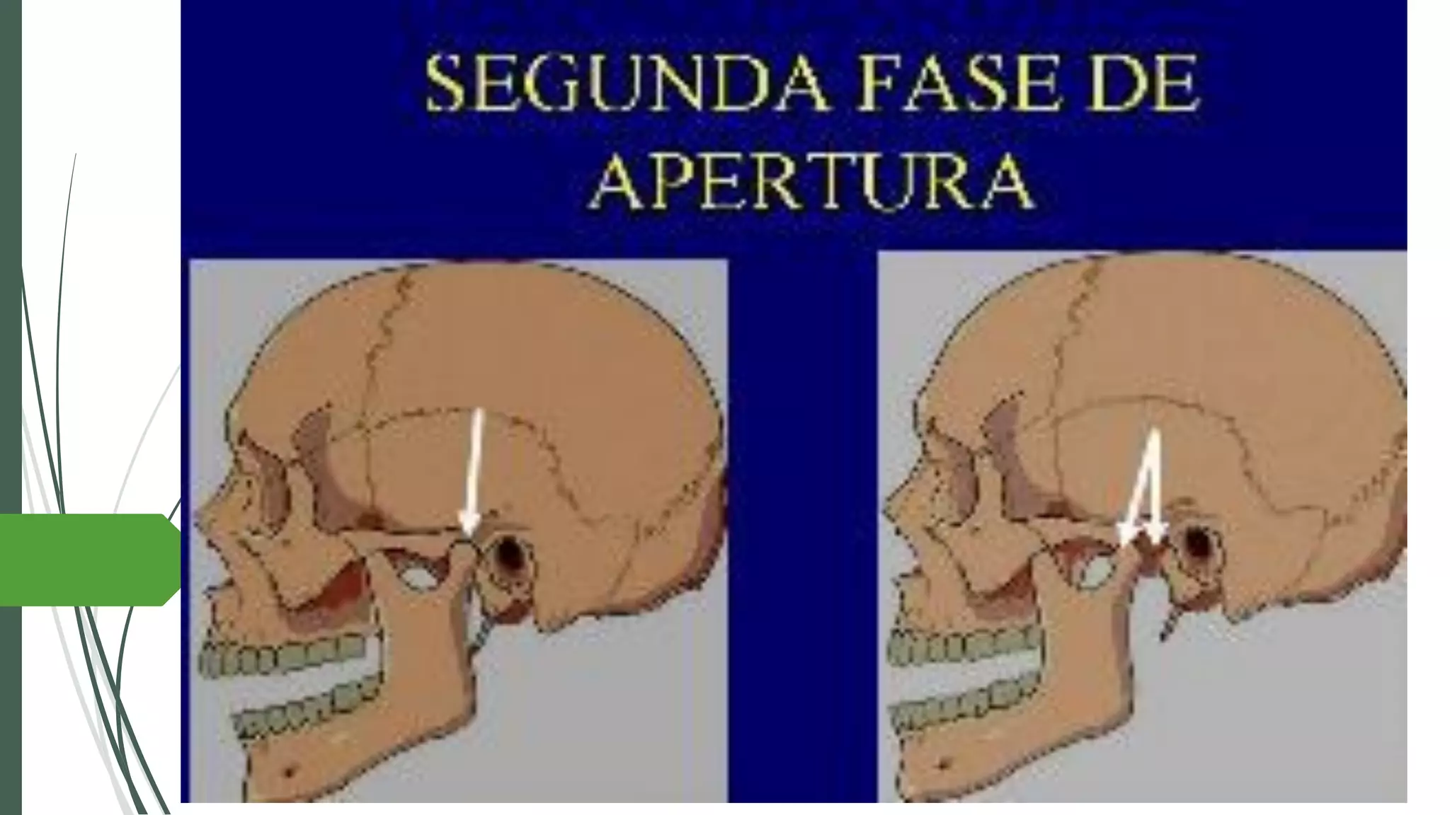 2 INTERSEDES - ATM, MUSCULOS Y DINÁMICA MANDIBULAR - 22122022.pdf