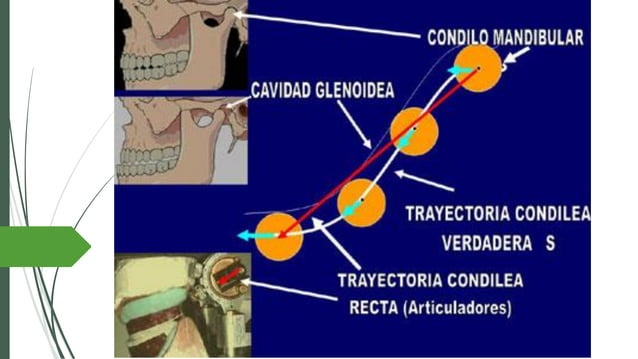 2 INTERSEDES - ATM, MUSCULOS Y DINÁMICA MANDIBULAR - 22122022.pdf