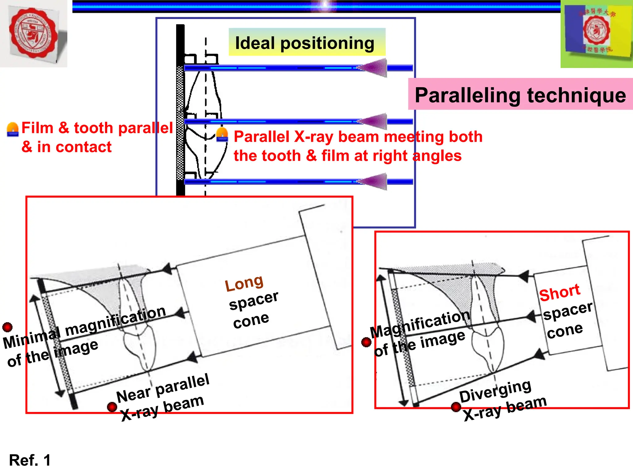 intraoral radiography of jaw in dentistry.ppt