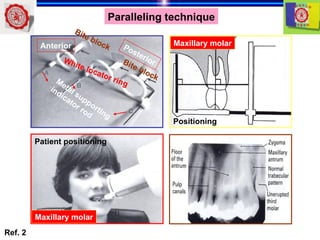 intraoral radiography of jaw in dentistry.ppt