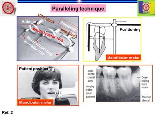 intraoral radiography of jaw in dentistry.ppt