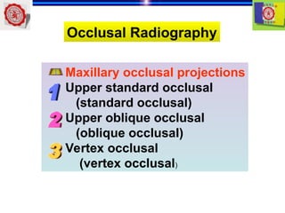 intraoral radiography of jaw in dentistry.ppt