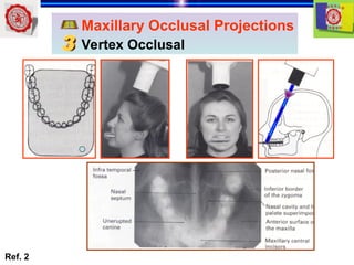 intraoral radiography of jaw in dentistry.ppt
