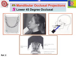 intraoral radiography of jaw in dentistry.ppt