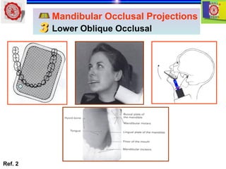intraoral radiography of jaw in dentistry.ppt