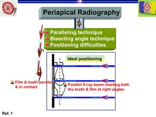 intraoral radiography of jaw in dentistry.ppt
