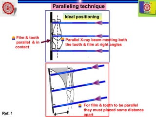 intraoral radiography of jaw in dentistry.ppt