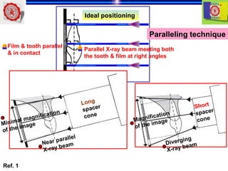 intraoral radiography of jaw in dentistry.ppt