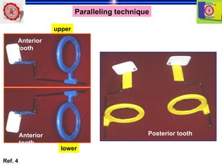 intraoral radiography of jaw in dentistry.ppt