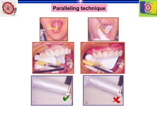 intraoral radiography of jaw in dentistry.ppt