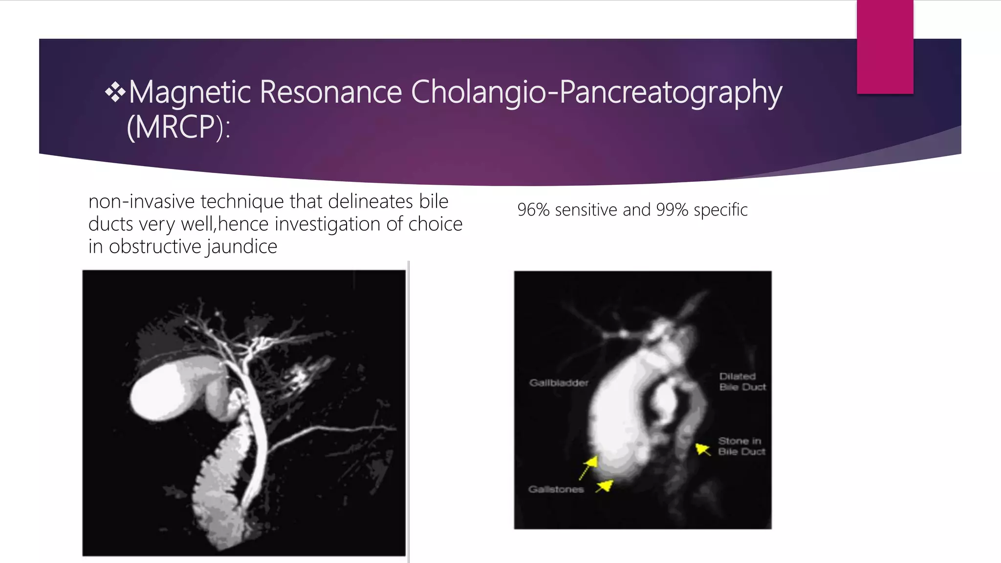 INVESTIGATIONS OF A PATIENT WITH OBSTRUCTIVE JAUNDICE -LETS GO | PPTX