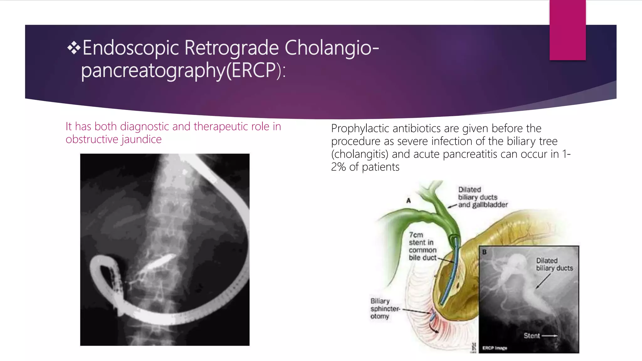 INVESTIGATIONS OF A PATIENT WITH OBSTRUCTIVE JAUNDICE -LETS GO | PPTX