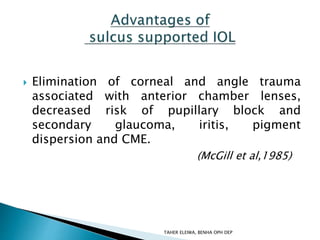 secondary IOL implantation | PPTX