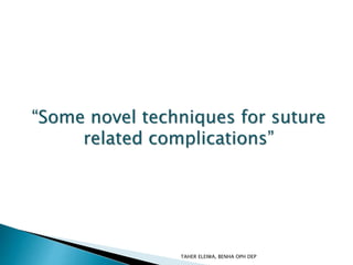 secondary IOL implantation | PPTX