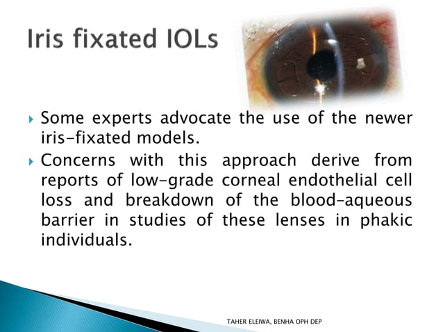 secondary IOL implantation | PPTX
