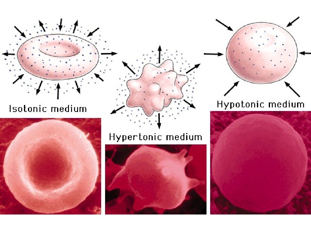 Chapter 3 Movement of Substances Lesson 2 - Effects of isotonic, hypo…