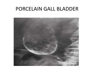 what is jaundice ? causes ? types ? surgical treatment | PPTX