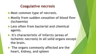 Necrosis and it's types | PPTX