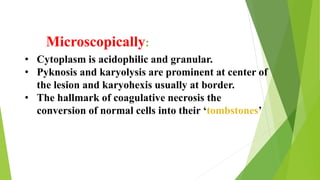 Necrosis and it's types | PPTX
