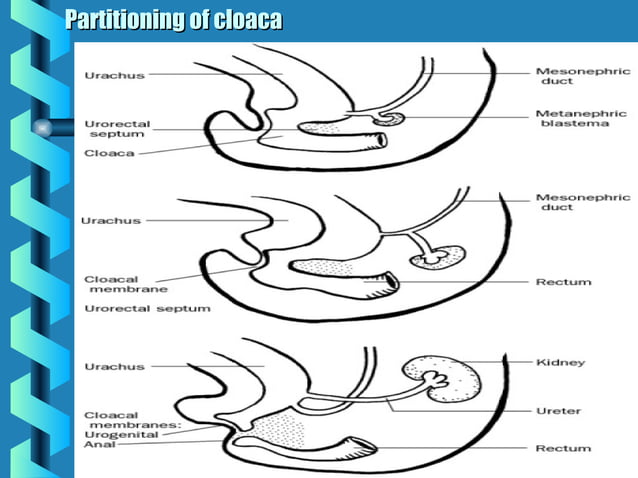 Embryology of Digestive system | PPT | Digestive Disorders | Diseases ...