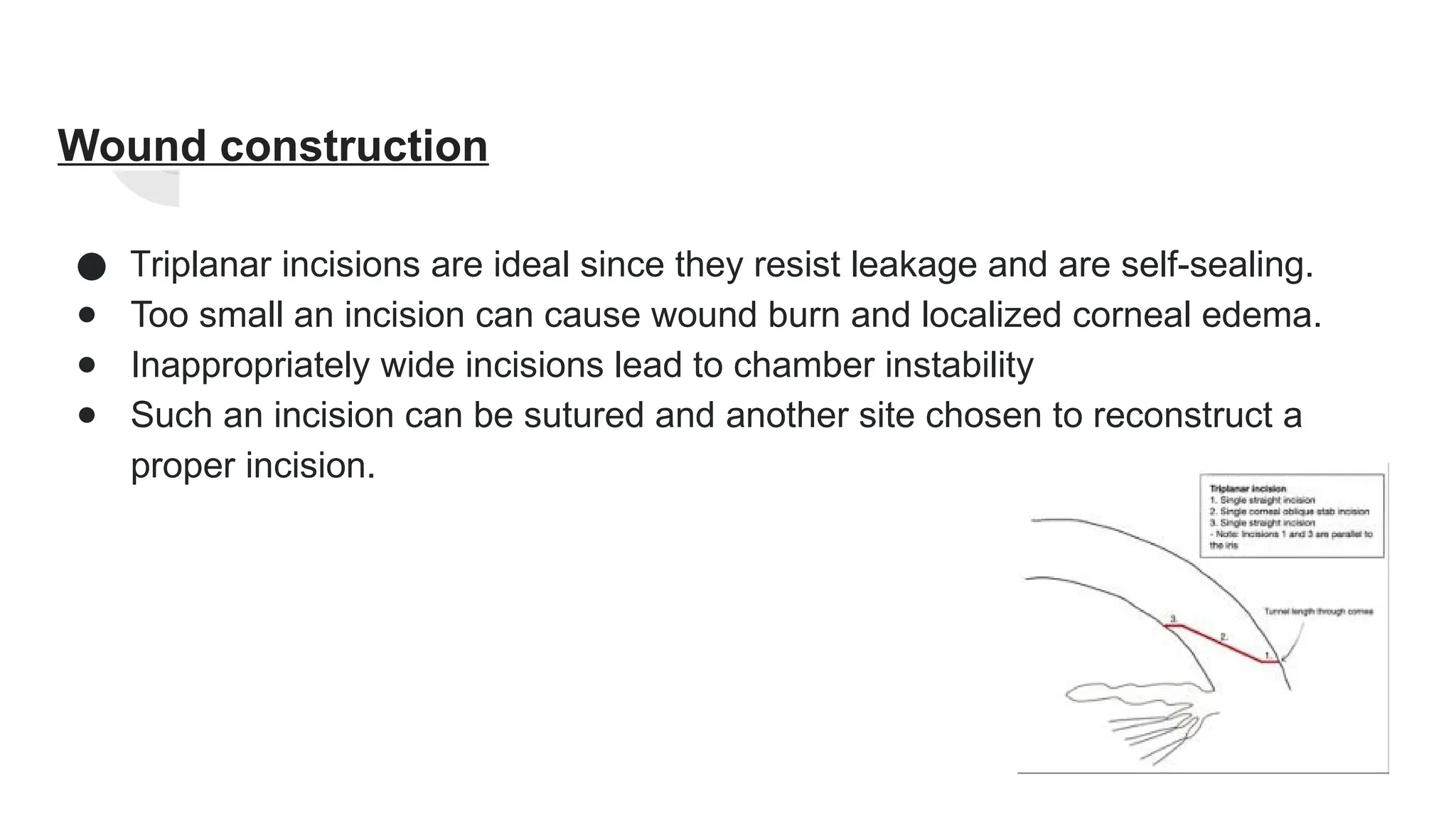 posterior capsular rent and nucleus drop | PPTX