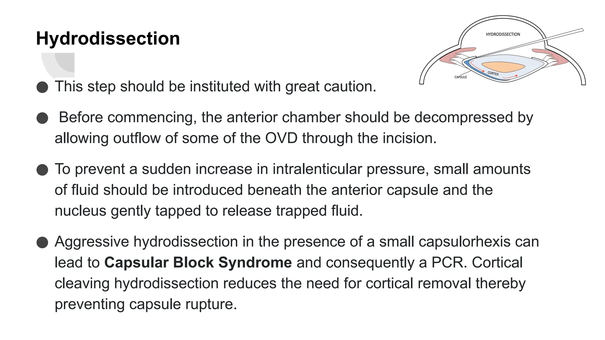 posterior capsular rent and nucleus drop | PPTX