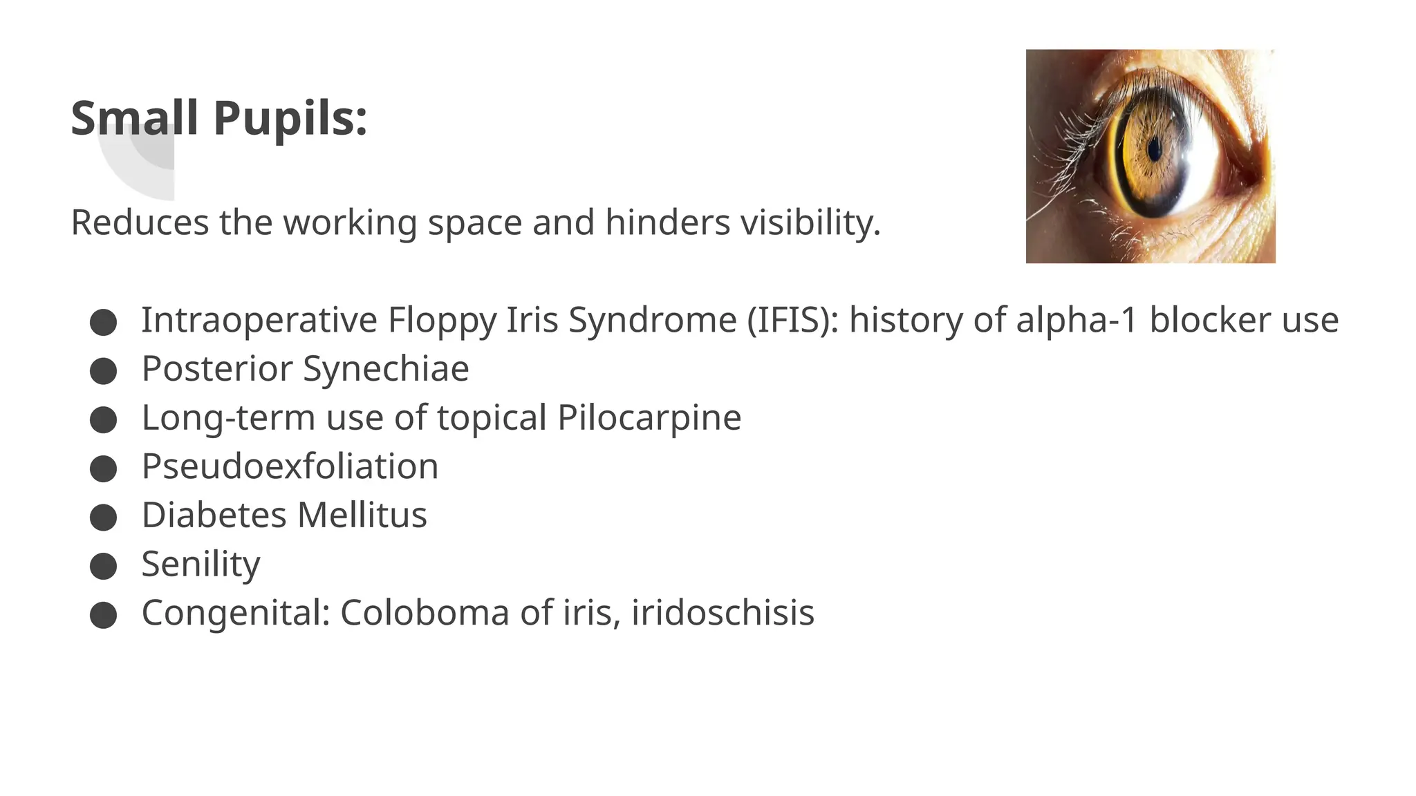 posterior capsular rent and nucleus drop | PPTX