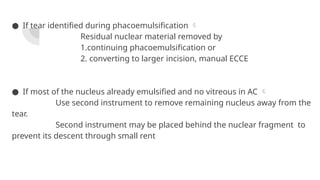 posterior capsular rent and nucleus drop | PPTX